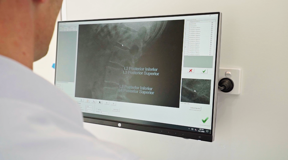 Insight Scans & Digital Motion X-Ray